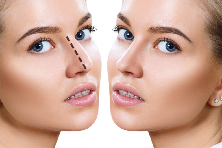 Tired of Your Curved Nose? – Eagle 93